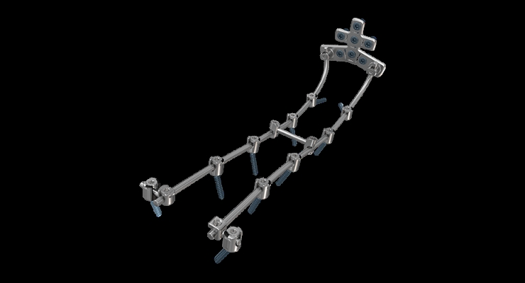 K2M Receives FDA Clearance for Next-Generation YUKON OCT Spinal System ...