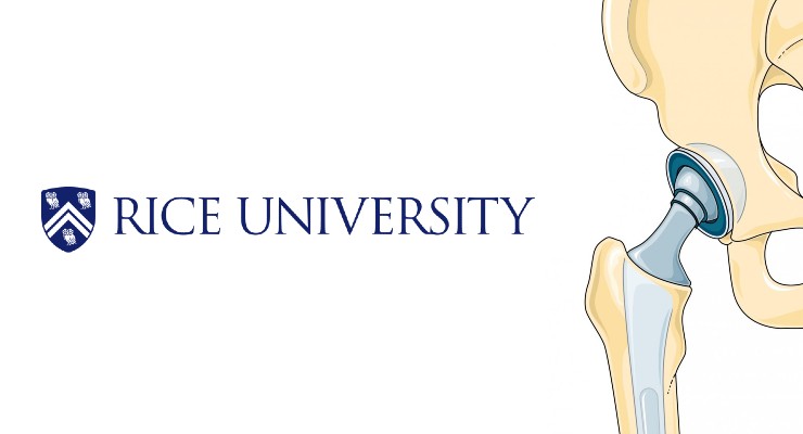 Rice U. Computational Model Offers Help for New Hips - ODT