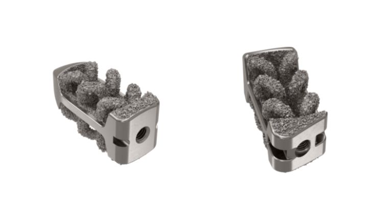 Camber Spine Enters Next Phase of Launch of SPIRA-P Posterior Lumbar ...