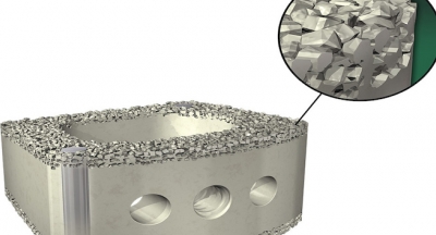 Vertera Spine Gets FDA Clearance for Spine Implant with Unique Porous ...