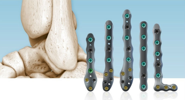 In2Bones Launches CoLink Afx Ankle Fracture Repair System - ODT