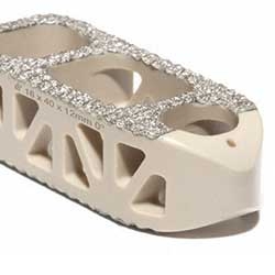 Spinal Elements Titanium-Coated Implants Cleared by FDA - ODT