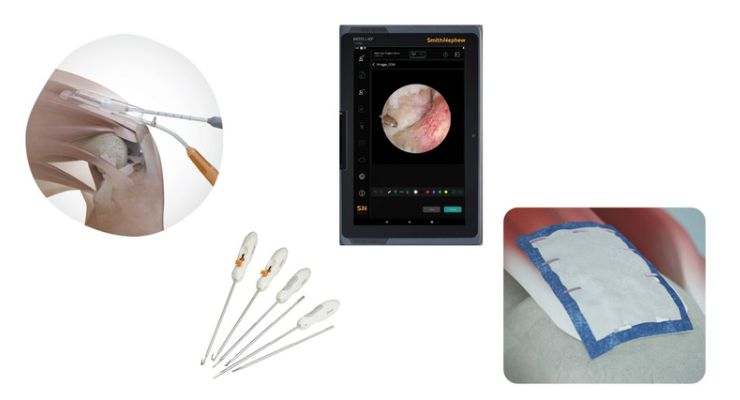 AAOS News: Smith+Nephew Highlights Sports Med Procedural Innovations - ODT
