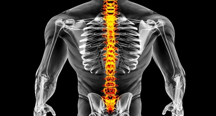 FDA OKs First Nanotechnology PEEK Devices for Spinal Intervertebral ...