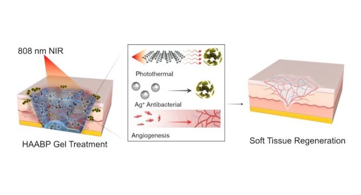 Researchers Develop Hydrogel Injections to Treat Antibiotic-Resistant ...