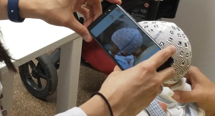 'Photomedas' System Measures Infant Cranial Deformation with a Mobile Phone - ODT