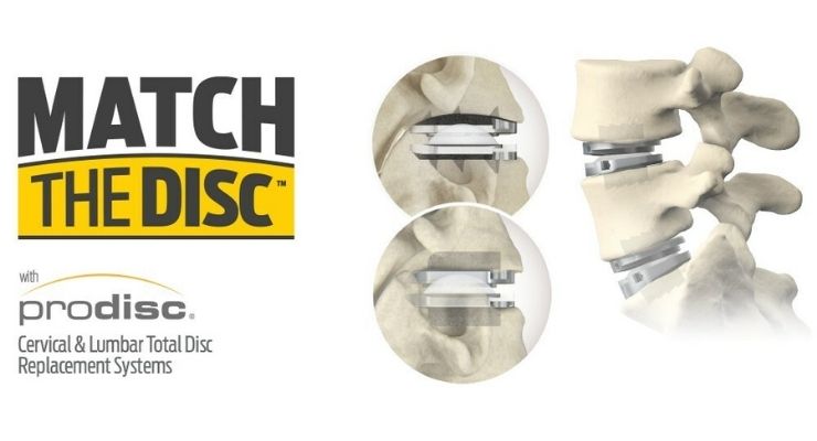 NASS News: Centinel Spine to Highlight prodisc Match-the-Disc Systems - ODT