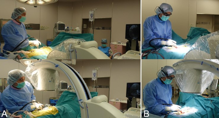 Eyeglass-Attached Display Provides Fluoroscopic Guidance During Spine ...