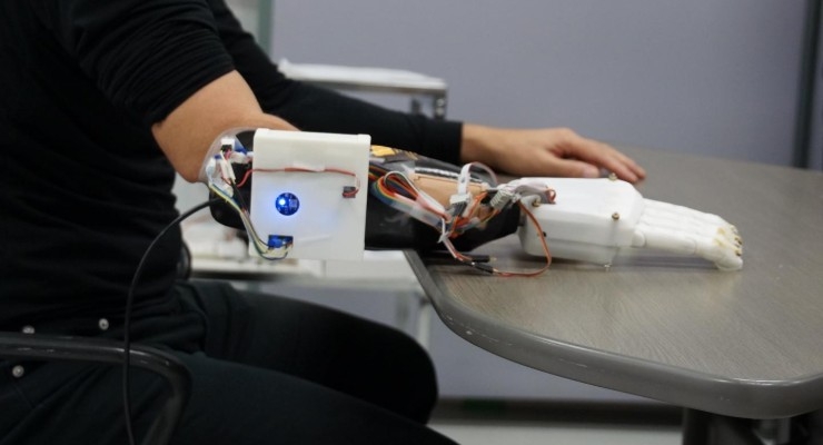 3D Printed Prosthetic Hand Learns Wearer's Movement Patterns - ODT