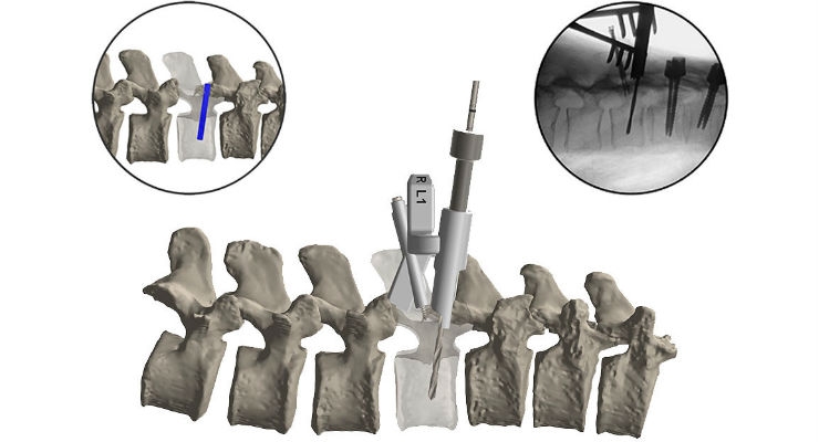 Spinal Elements, Mighty Oak Medical Team Up to Market FIREFLY Surgical ...