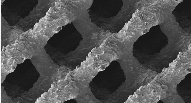 EIT Emerging Implant Technologies Acquires 22 Patents for 3D Printed ...