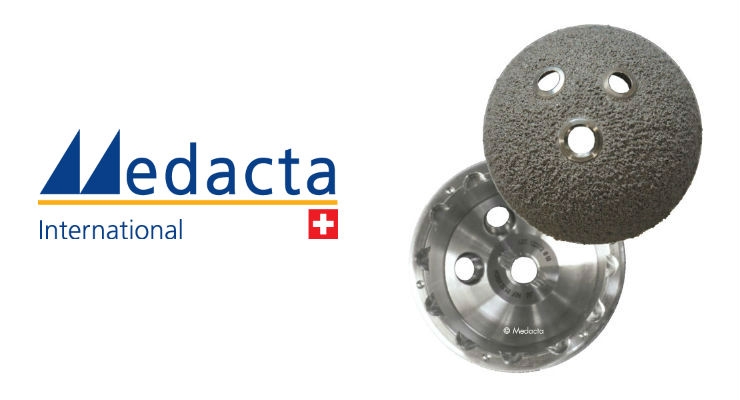 Medacta Adds 3D Metal Implants and Augments to Mpact System for Hip ...