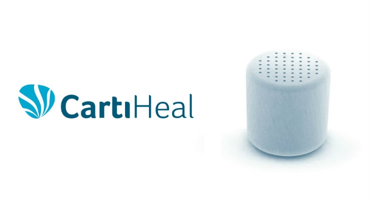 First U.S. Patients Receive Agili-C Implants to Treat Joint Surface ...