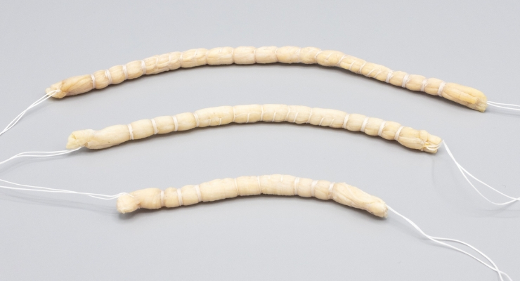 AlloSource Rolls Out AceConnex Pre-Sutured Fascia for Hips - ODT