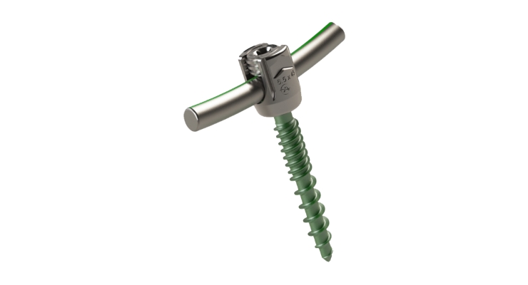 FDA Clears Altus Spine's Monaco Pedicle Screw System - ODT