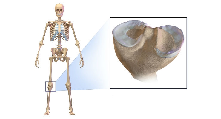 Ceterix Orthopaedics Wins New Patent for Meniscus Repair ...