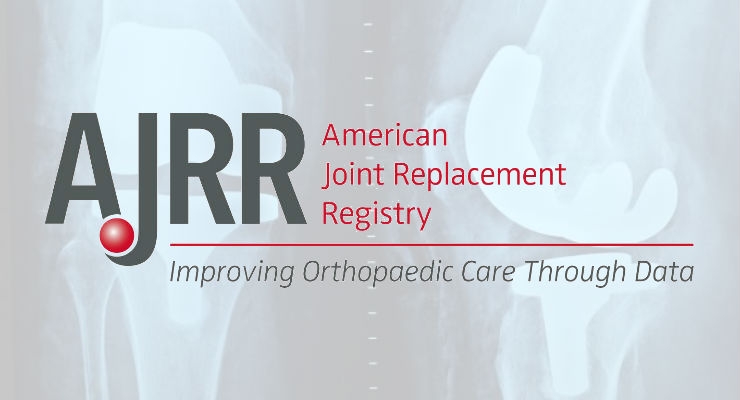 Facilitating the Development of Implant Survivorship Curves - ODT