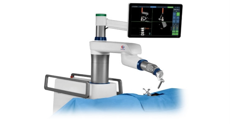 Globus Medical's ExcelsiusGPS Robotic Guidance & Navigation System ...