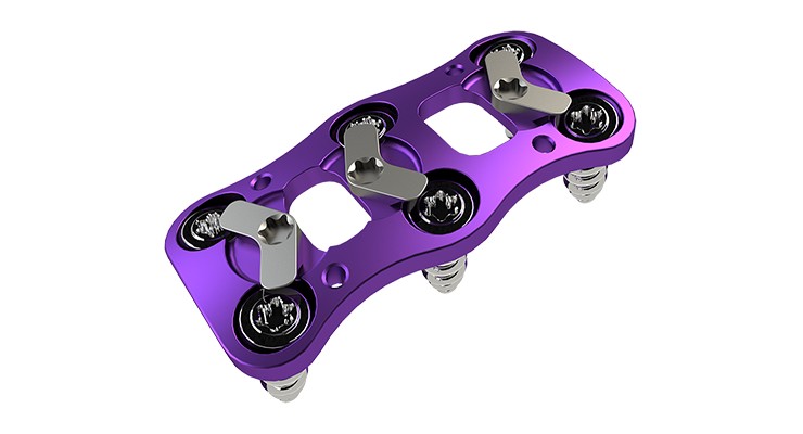 Aurora Spine Celebrates First APOLLO ACP Surgeries - ODT