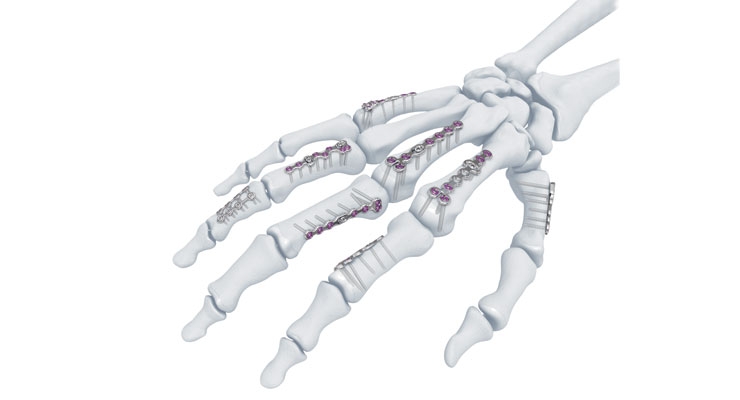 Going to Extremes - ODT