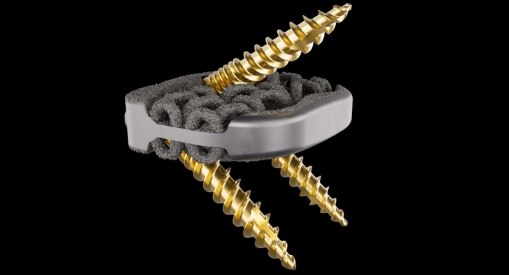 FDA Clears Camber Spine's SPIRA-A Integrated ALIF - ODT