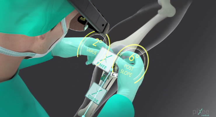 Pixee Medical’s Knee+ Orthopedic Solution Cleared by FDA - ODT