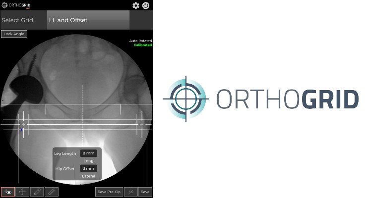 OrthoGrid Releases New Hip Replacement Software - ODT