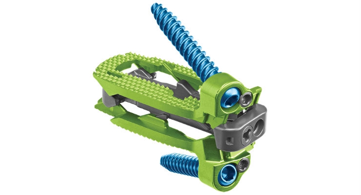 Globus Medical Launches ELSA Expandable Lateral Spacer System - ODT