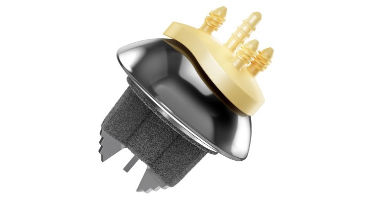 DJO Launches AltiVate Anatomic CS EDGE Shoulder System - ODT