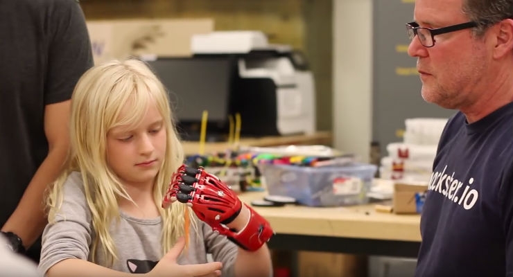 3D Printing a Prosthetic 'Super Hand' - ODT