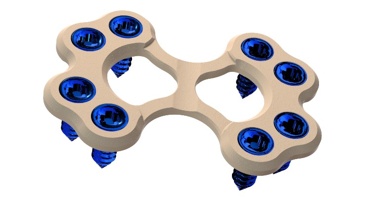 FDA OKs Able's Valkyrie Thoracic Fixation System - ODT