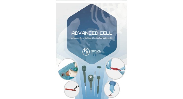 Royal Biologics Debuts Advanced Bone Grafting, Fusion Kit - ODT