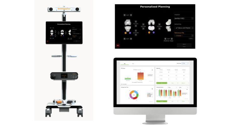 Smith+Nephew Introduces AI-Powered Planning Software, Data ...