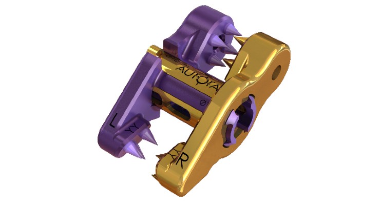 Aurora Spine's ZIP Implants Earn FDA OK for Lumbar Spinal Stenosis - ODT