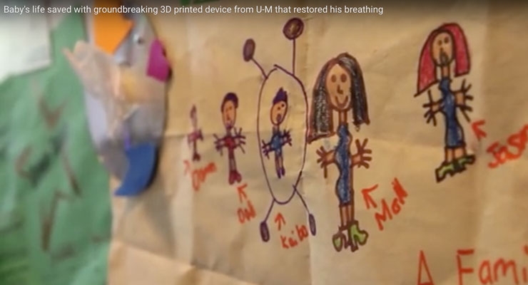 Materialise Partners With University on 3-D Printed Tracheal Splints - ODT