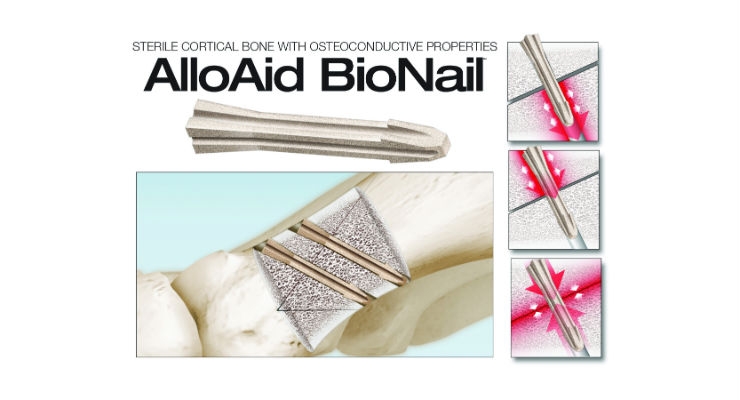 In2Bones Launches Natural Alternative to Metal Implants - ODT