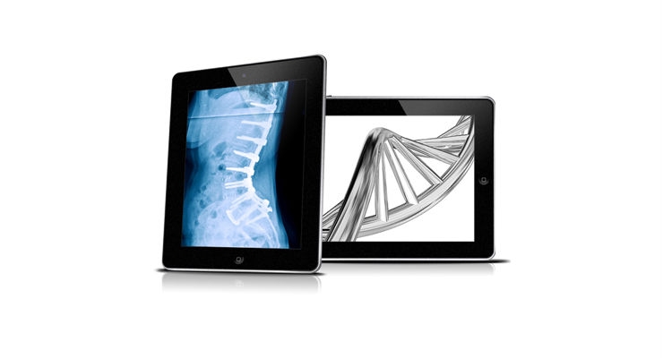NASS News: Medicrea Unveils UNiD HUB Surgical Planning Through Machine ...