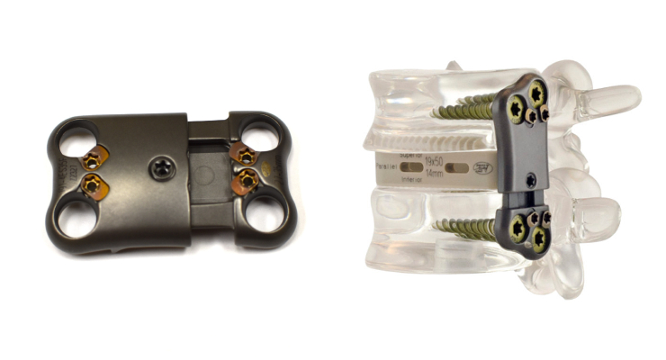 Zavation Launches New Lumbar Plates - ODT