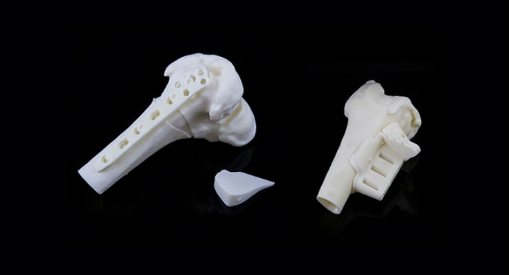 AAOS: Materialise Launches 3D-Printed, Patient-Specific Osteotomy ...