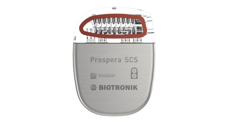 Biotronik Releases Promising BENEFIT-02 Trial Results for Prospera SCS ...