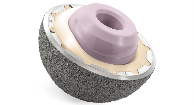 UOC’s Polyethylene Hip Liner Cleared - ODT