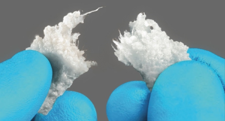 FDA Clears Biogennix’s Moldable Bone Grafting Solution for Spine ...