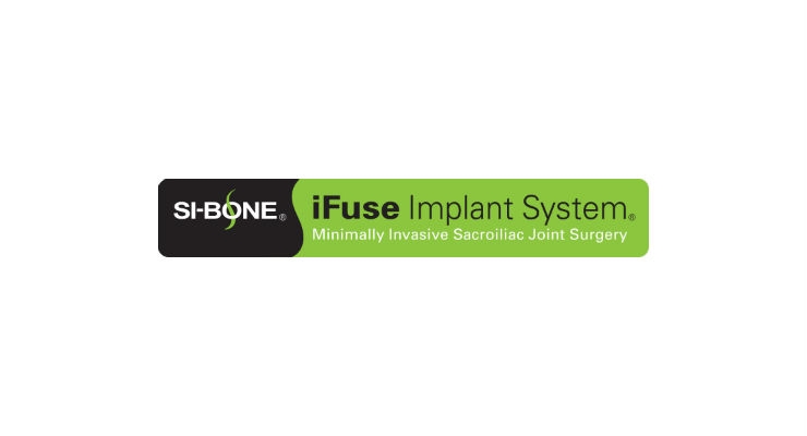 SI-BONE Publishes 3-Year Post-SI Joint Fusion Data for Triangular iFuse ...