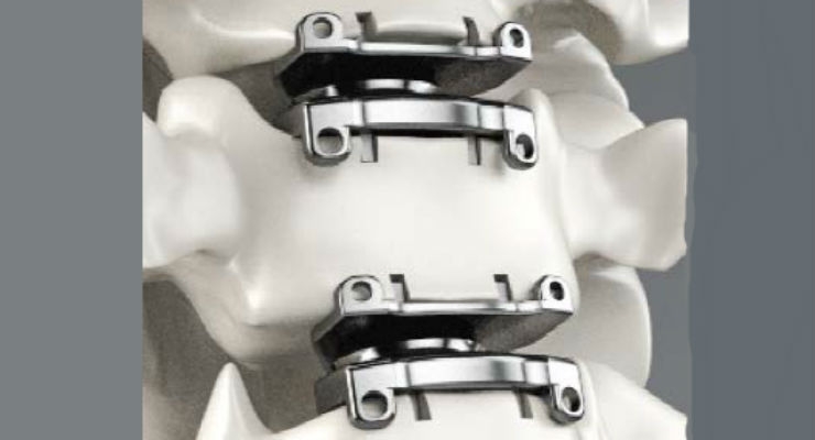FDA Approval for Medtronic’s Two-Level Prestige LP Cervical Disc ...