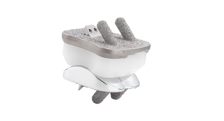 AAOS News: Smith+Nephew Launches New Ankle, Shoulder Replacement Tech - ODT