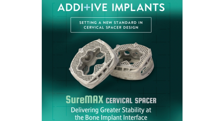 FDA Clears Additive Implants' 3D Printed SureMAX Cervical Spacer System - ODT