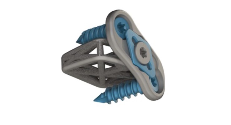 4WEB Medical Launches Cervical Spine Integrated Plating Solution - ODT