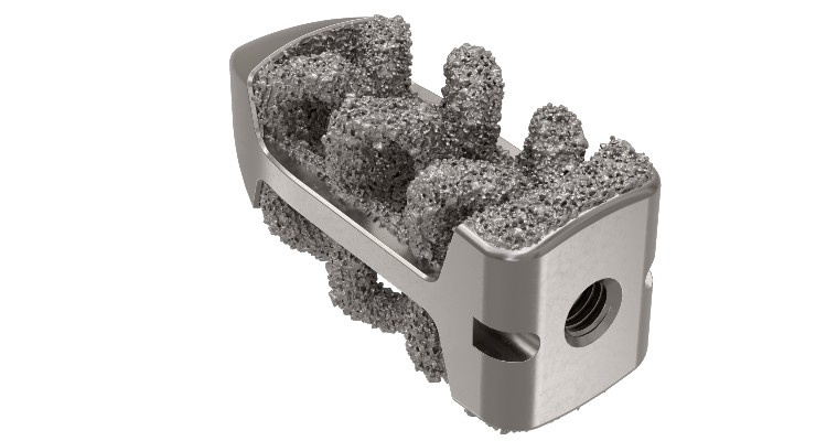 Camber Spine Announces Clinical Education & Product Portfolio ...