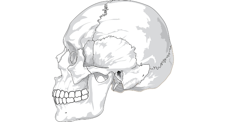 3D-Printed 'Hyperelastic Bone' May Help Generate New Bone for Skull ...