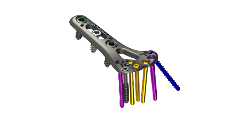 FDA Clears Orthopaedic Implant Company's Wrist Fracture Plate - ODT